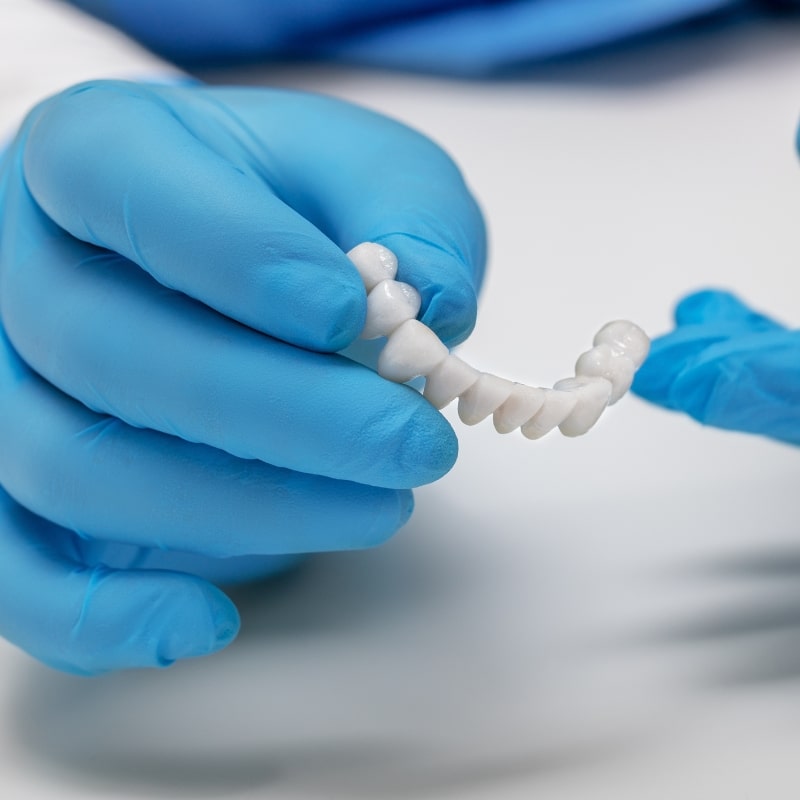 Crown Replacement Timeline and Costs in Sydney